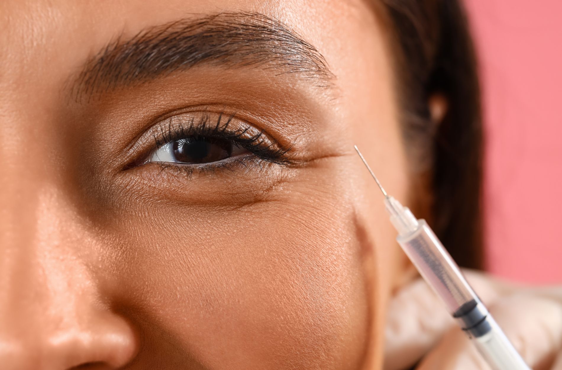 Facial Fillers: The Ultimate Guide to Looking Fresh